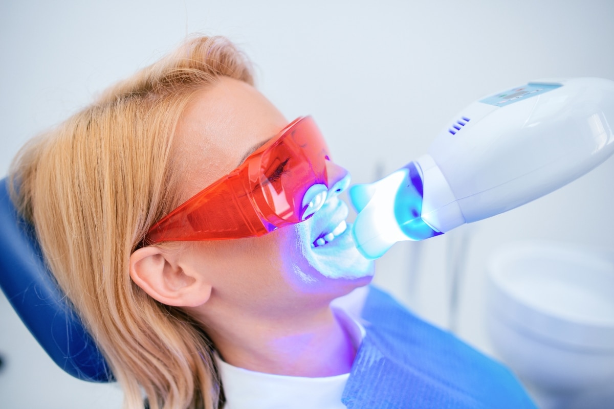 Tips for Maintaining Your Bright Smile After Teeth Whitening in Roseville